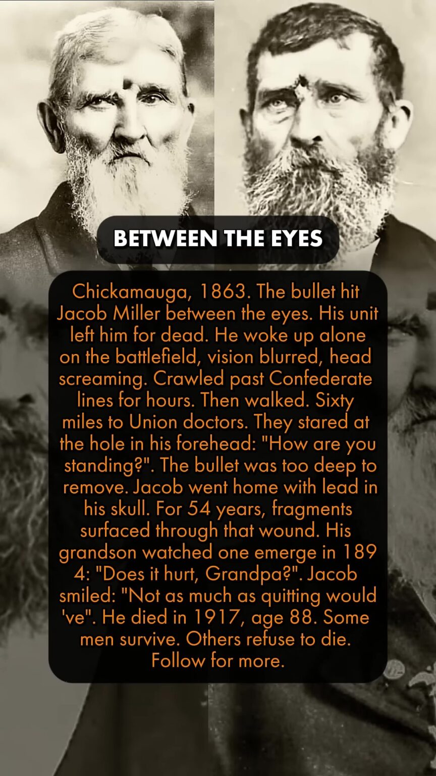 Jacob Miller didn’t just survive a bullet to the brain—he lived 54 ...